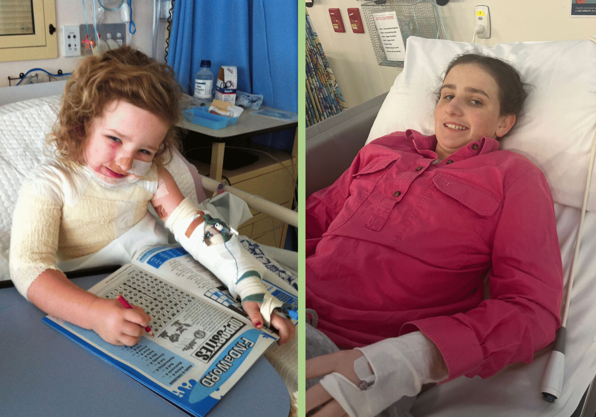 10 Years of innovation in paediatric burns care - Children's Hospital ...